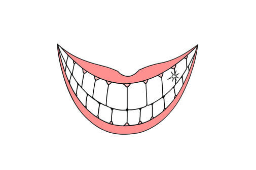 Nem kell, hogy feltétlenül létezzenek a fogsor árak – Mechwart Dental