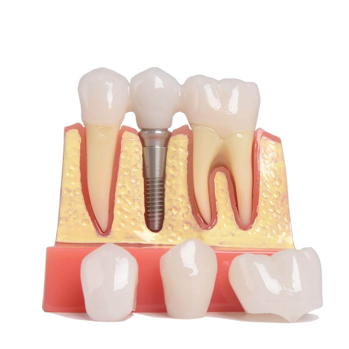 Blog – Mechwart Dental